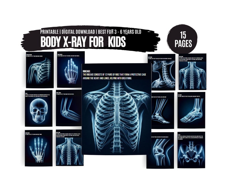 Human Body X-rays Printable Activity: Kids Pretend Play (digital ...