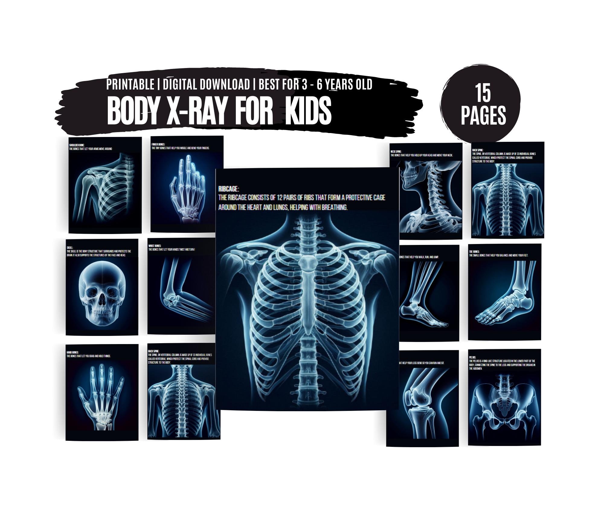 Human Anatomy Printable Activity for Kids | Human Body X-rays Activity Education for Preschool ...
