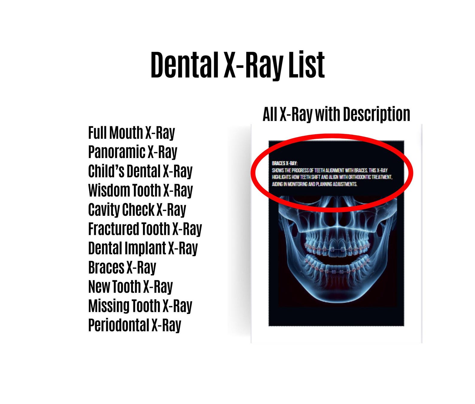 Printable Dental X-rays for Kids. Pretend Play Kids X-ray Activity for ...