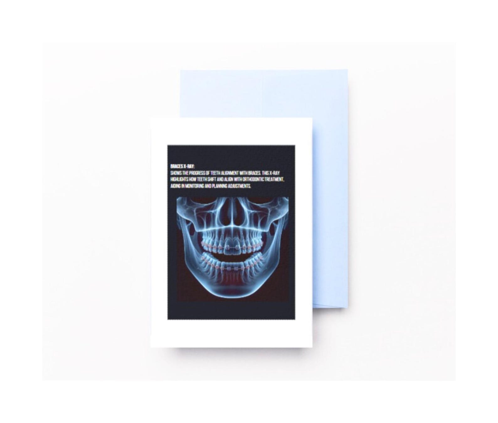 Printable Dental X-rays for Kids. Pretend Play Kids X-ray Activity for ...