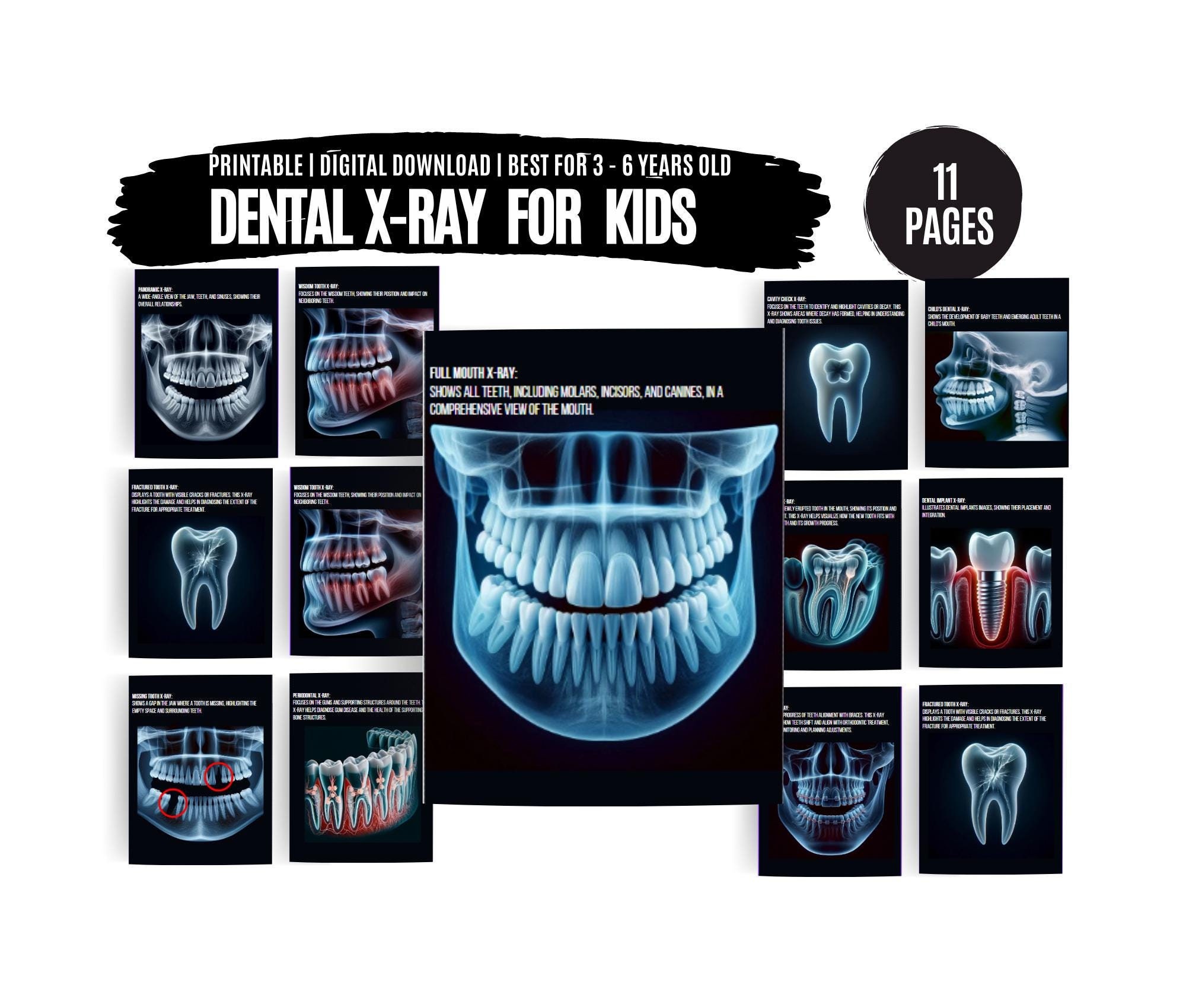 Printable Dental X-rays for Kids. Pretend Play Kids X-ray Activity for ...