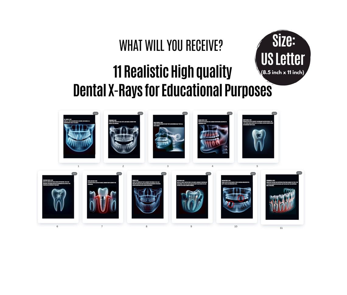 Printable Dental X-rays for Kids. Pretend Play Kids X-ray Activity for ...