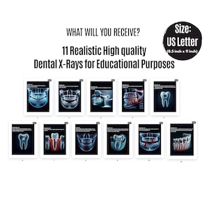 Printable Dental X-rays for Kids: Dentist Pretend Play (digital ...