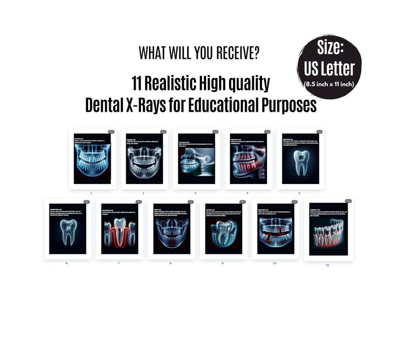 Printable Dental X-rays for Kids. Pretend Play Kids X-ray Activity for ...