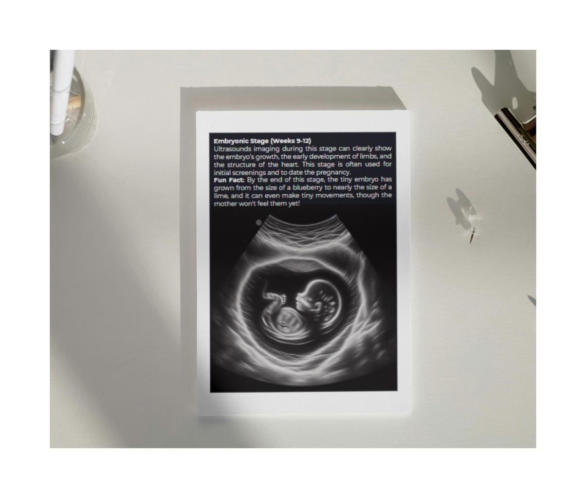 Baby Development Stages Printable: Simple Guide From Pregnancy to Birth ...