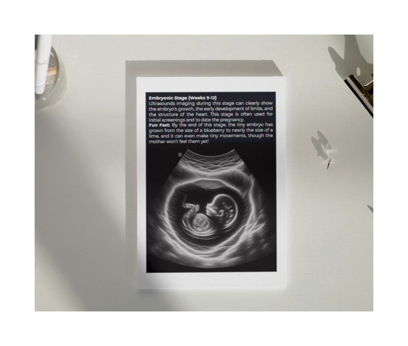 Baby Development Stages Printable: Simple Guide From Pregnancy to Birth ...