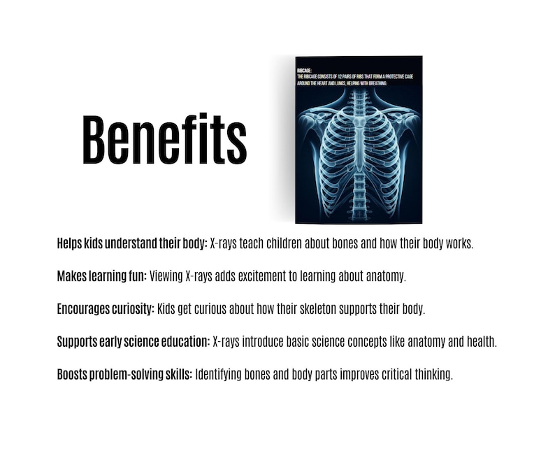 Human Body X-rays Printable Activity: Kids Pretend Play (digital ...