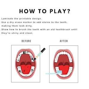 Dental Health Game Printable: Kids Teeth Brushing Practice (digital ...