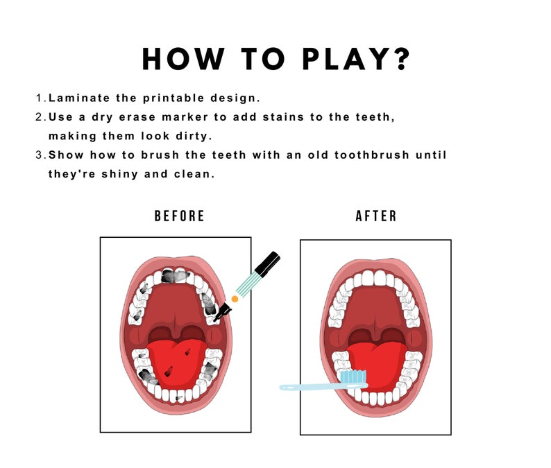 Dental Health Game Printable: Kids Teeth Brushing Practice (digital ...