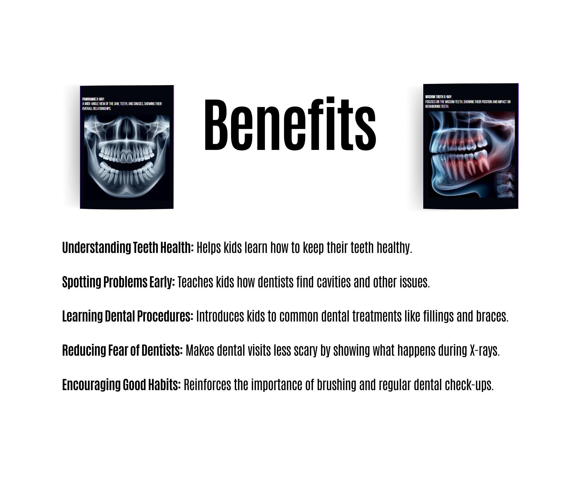 Printable Dental X-rays for Kids. Pretend Play Kids X-ray Activity for ...