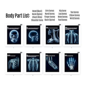 Human Body X-rays Printable Activity: Kids Pretend Play (digital ...
