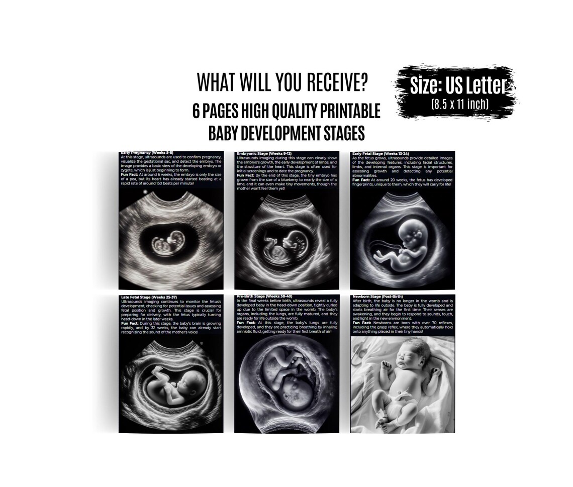 Baby Development Stages Printable: Simple Guide From Pregnancy to Birth ...