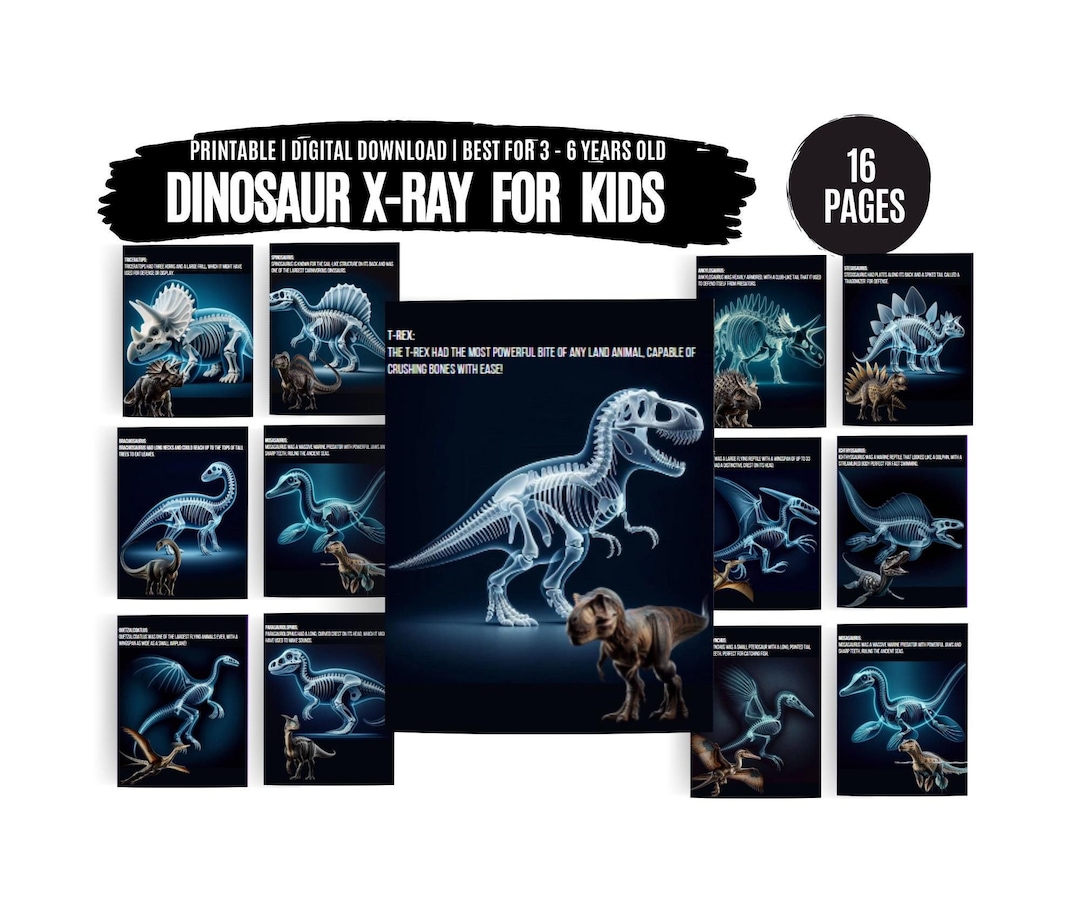 Dinosaur X-ray Printables: Kids Pretend Play, Anatomy Activity (digital ...
