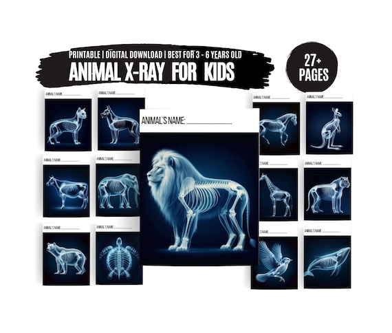 Printable X Ray Pictures For Kids