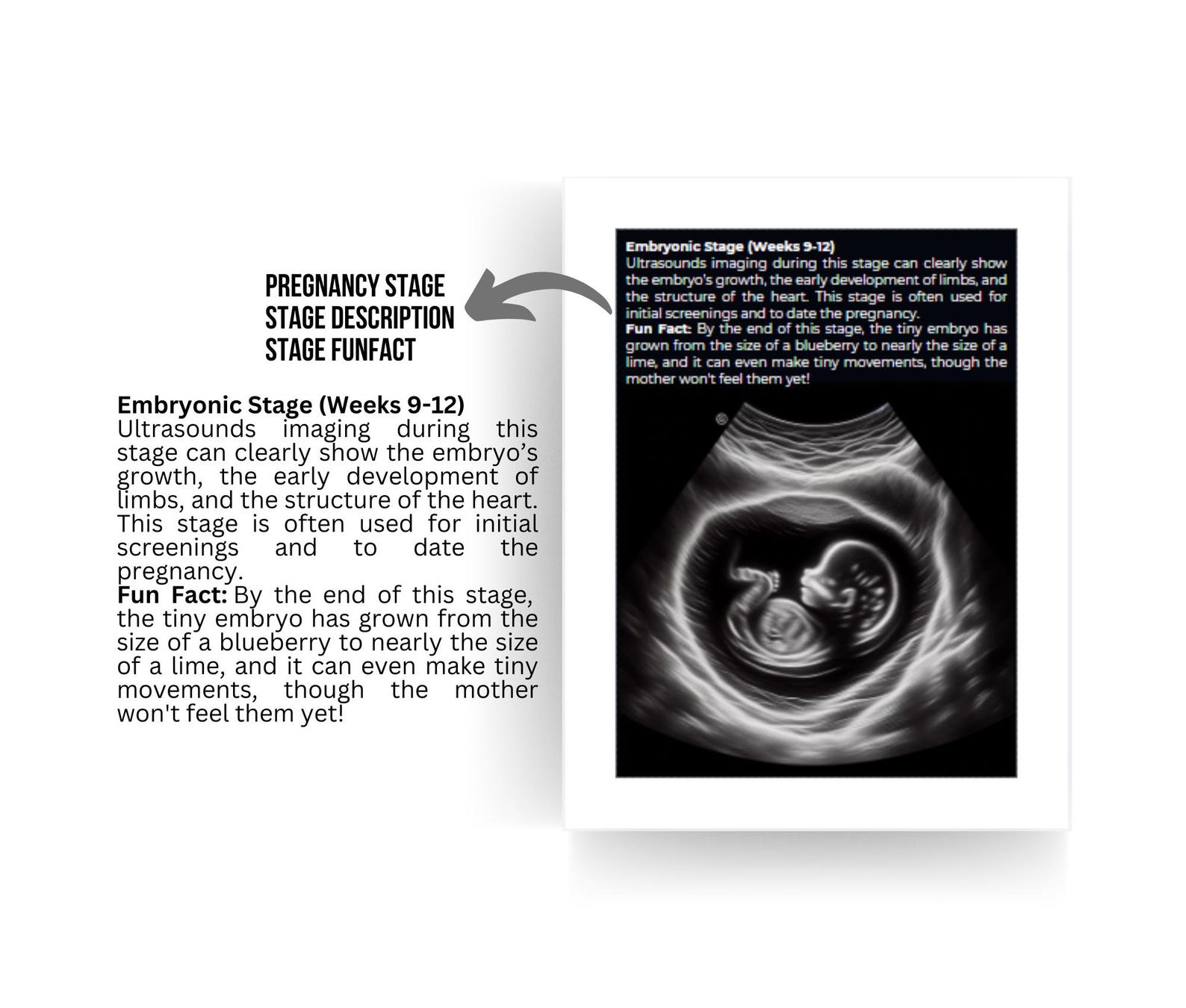 Baby Development Stages Printable: Simple Guide From Pregnancy to Birth ...