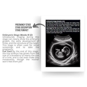 Baby Development Stages Printable: Simple Guide From Pregnancy to Birth ...