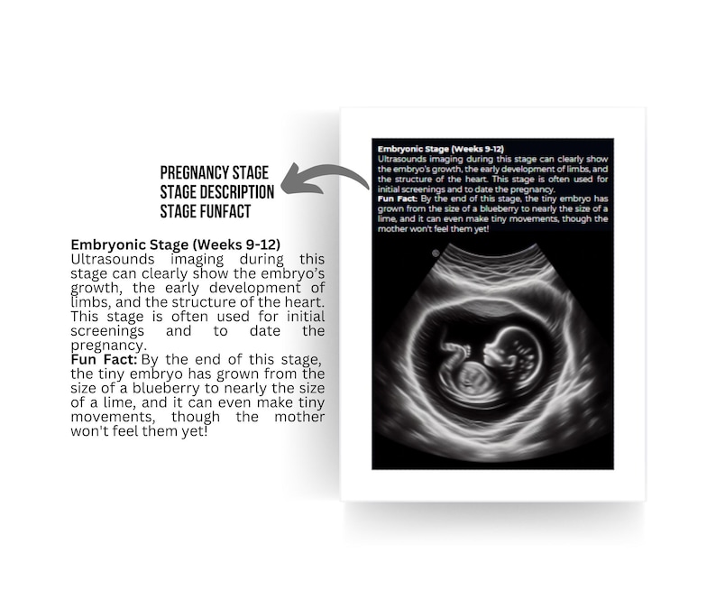 Baby Development Stages Printable: Simple Guide From Pregnancy to Birth ...