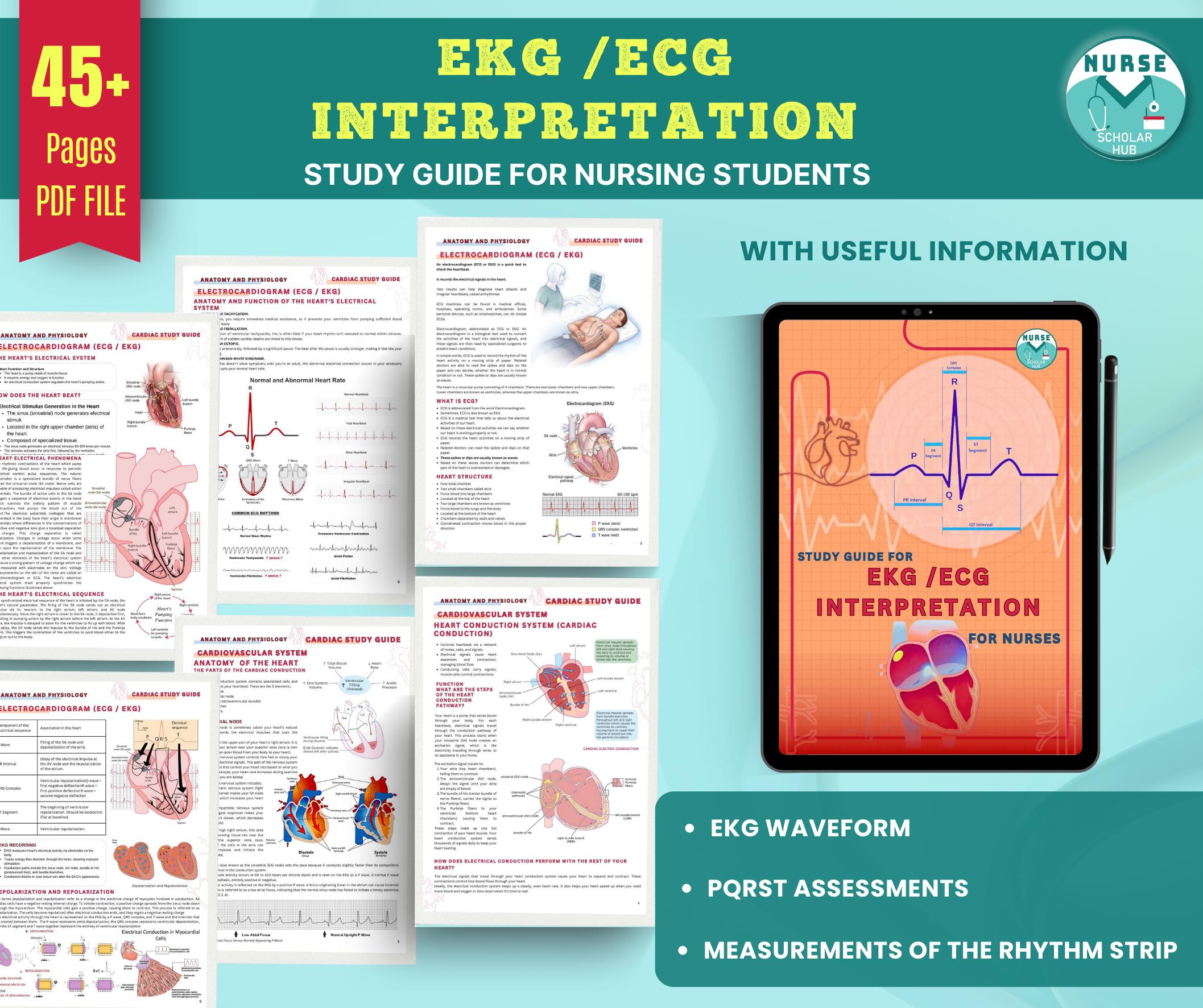 EKG ECG Interpretation Nursing Study Guide | Heart Rhythm & Arrhythmia ...