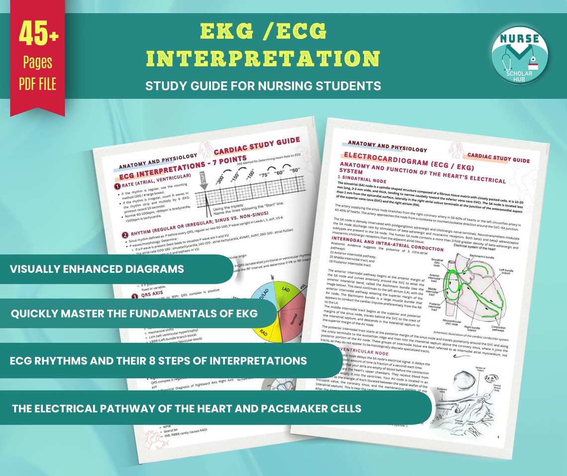 EKG ECG Interpretation Nursing Study Guide | Heart Rhythm Cheat Sheet ...