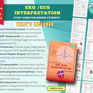 EKG ECG Interpretation Nursing Study Guide | Heart Rhythm Cheat Sheet ...