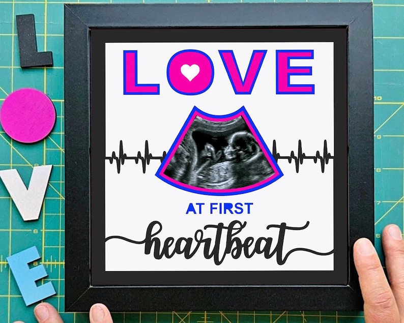 Baby Ultrasound Picture Frame, Baby Announcement Shadow Box, Laser, SVG ...