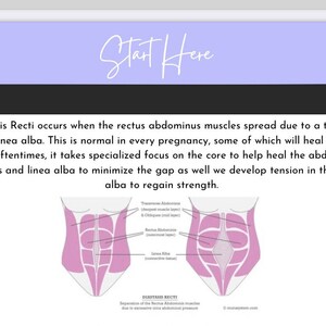 Diastasis Recti 21 Day Challenge - Etsy