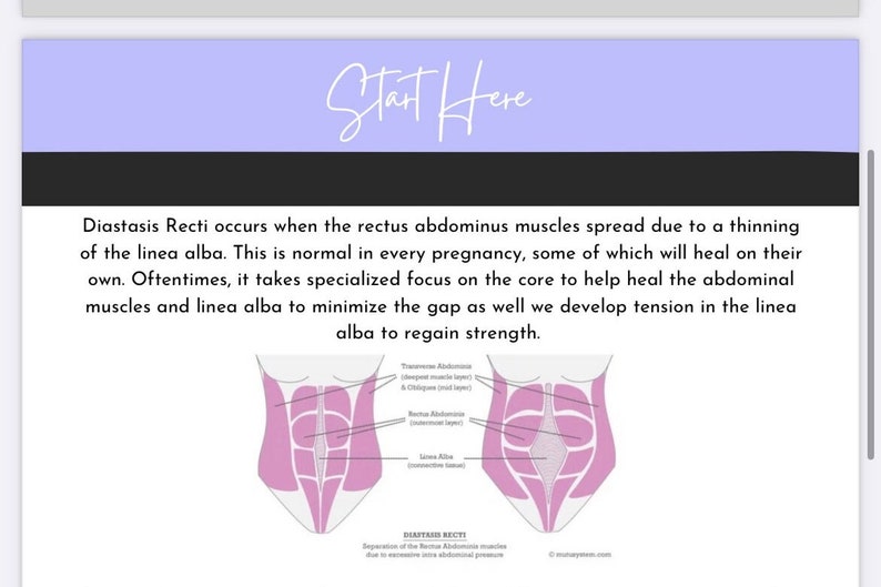 Diastasis Recti 21 Day Challenge - Etsy