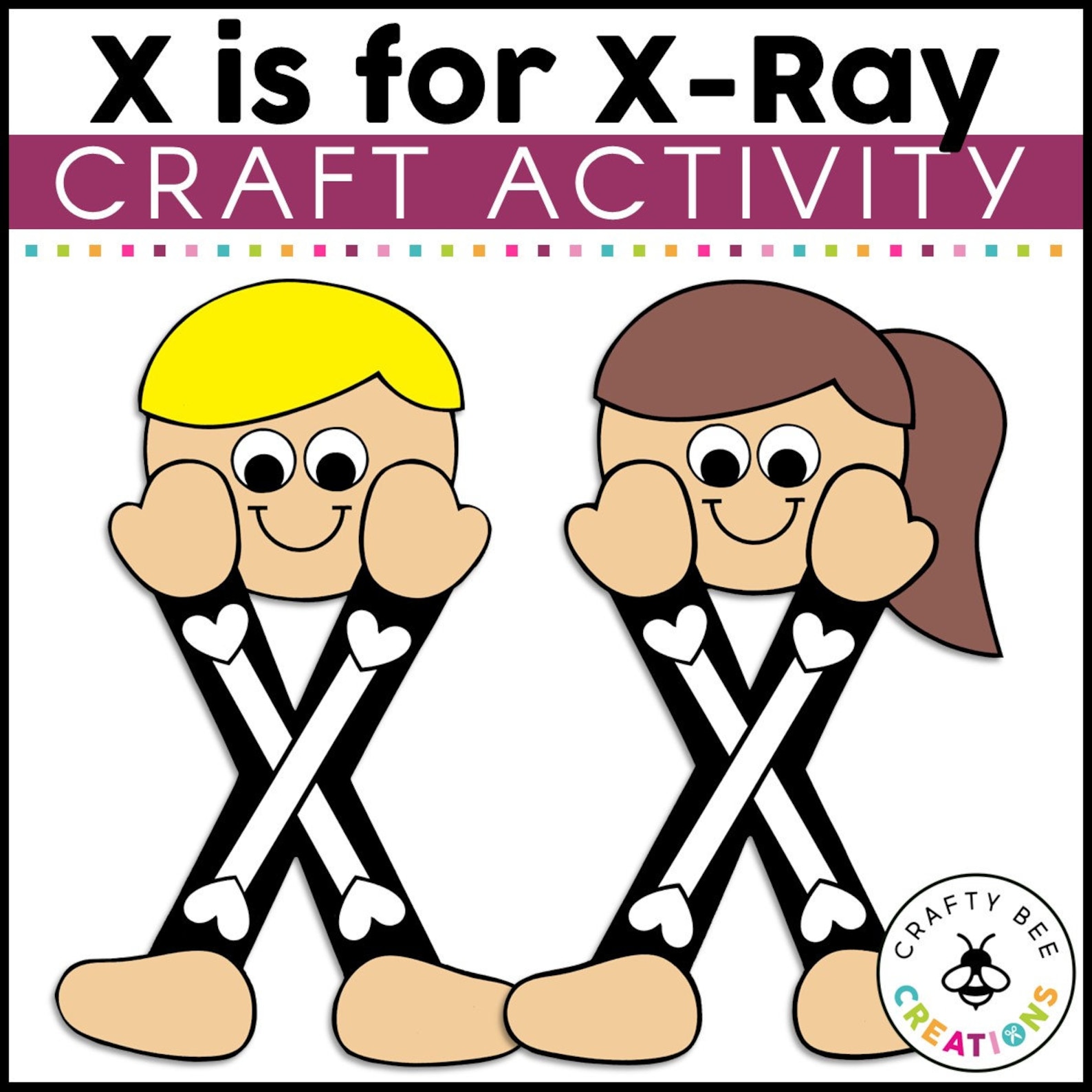 Letter X Craft Patterns | X-ray Craft | Alphabet Crafts | Uppercase ...