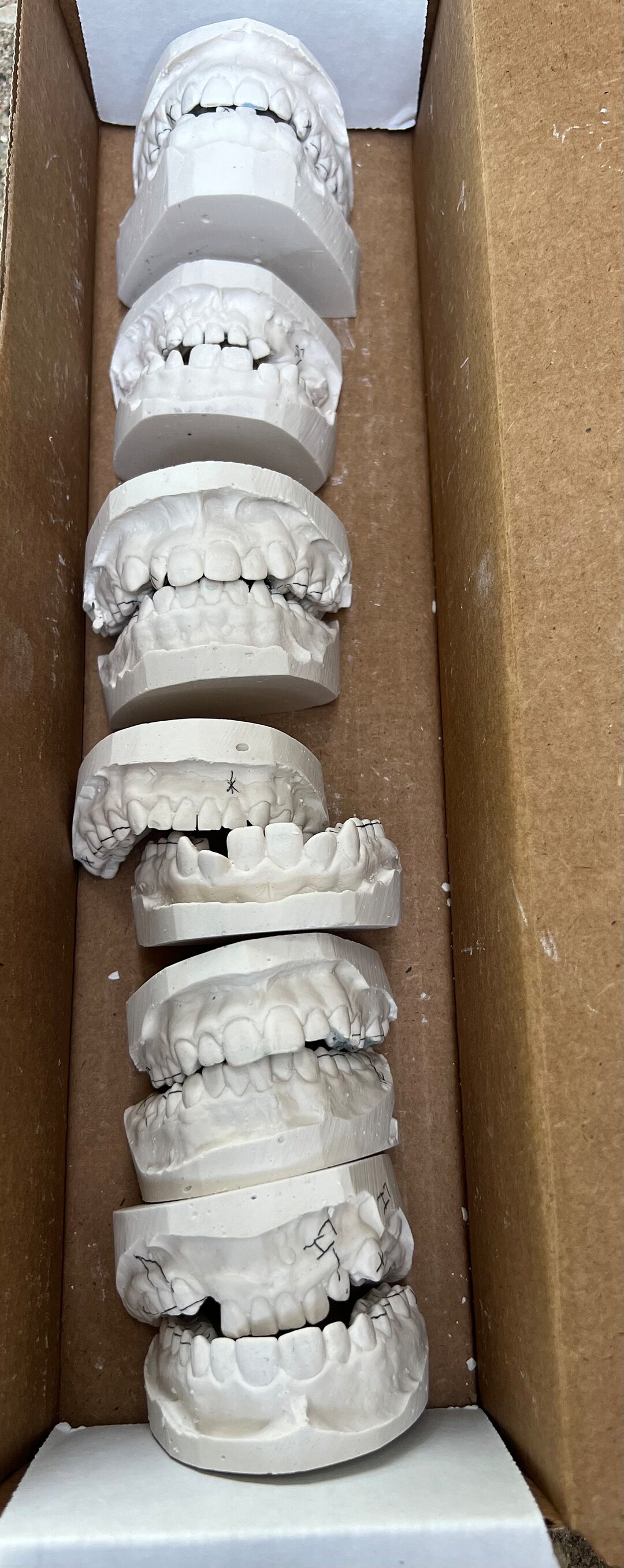 Stone Teeth Models - Etsy