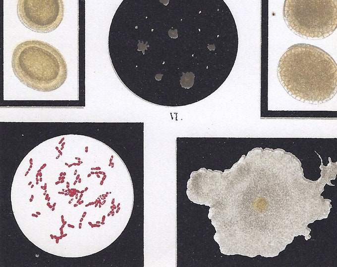 Bacterial Growth Patterns | 1899 | Antique Medical Lithograph | Rare ...