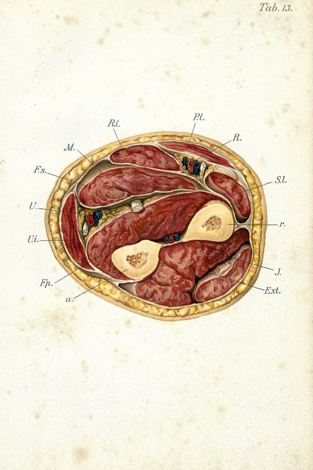 Forearm Cross Section | 1909 Colored Antique Medical Print - Detailed ...