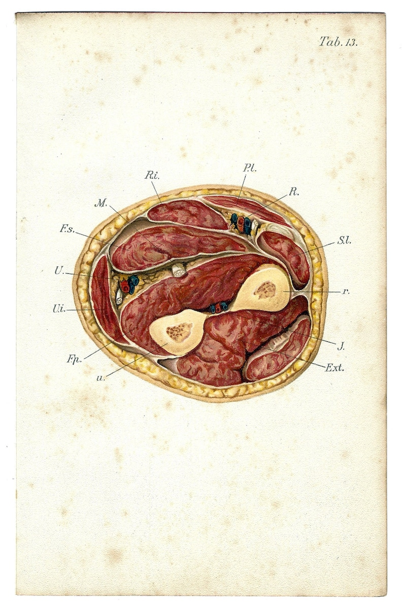 Forearm Cross Section | 1909 Colored Antique Medical Print - Detailed ...