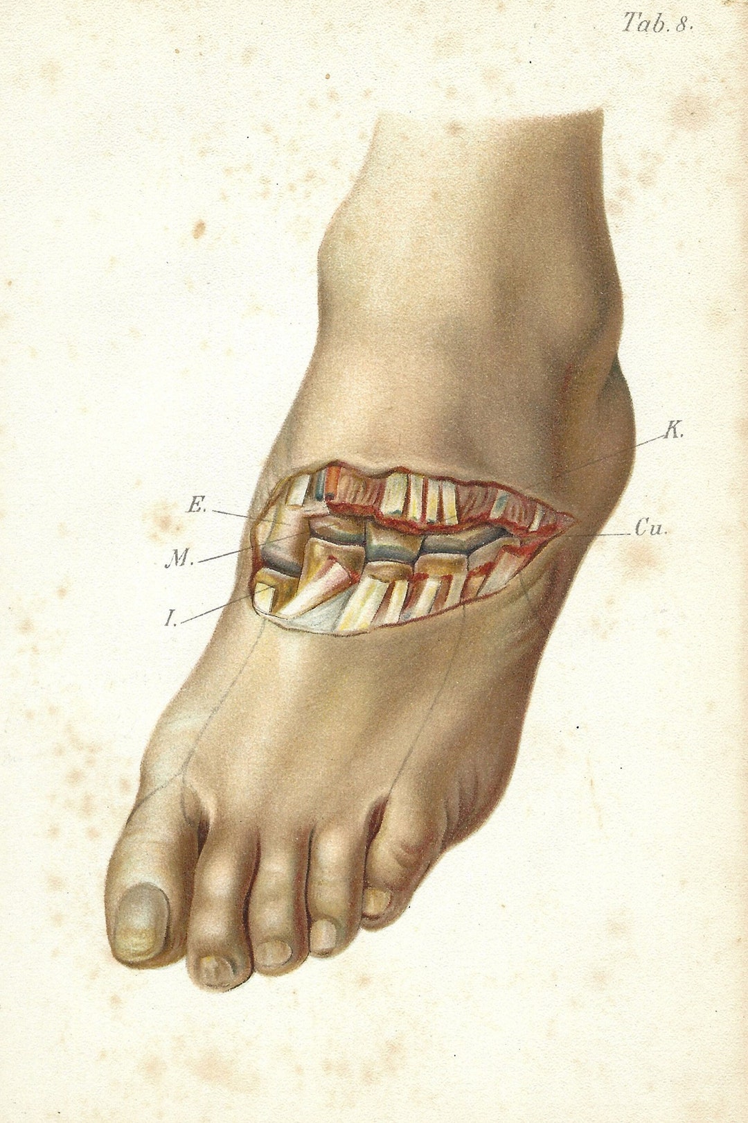 Anatomical Dissection of the Foot | 1909 Colored Antique Medical ...