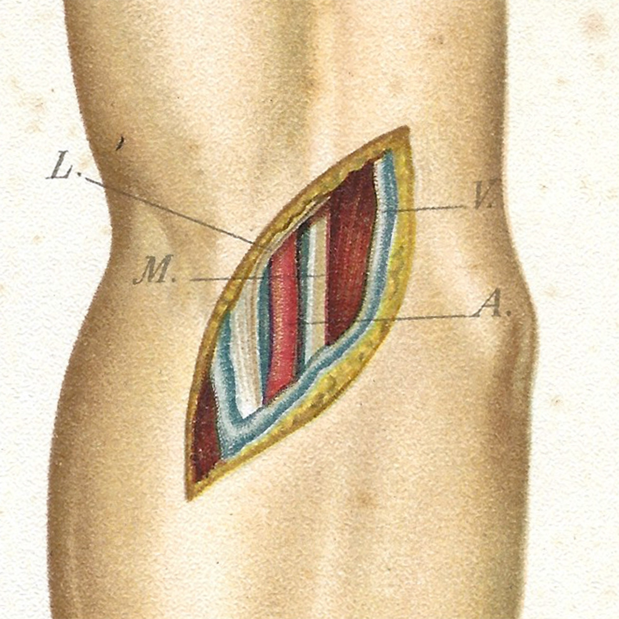 Forearm Arteries Exposure | 1909 Colored Antique Medical Lithograph ...