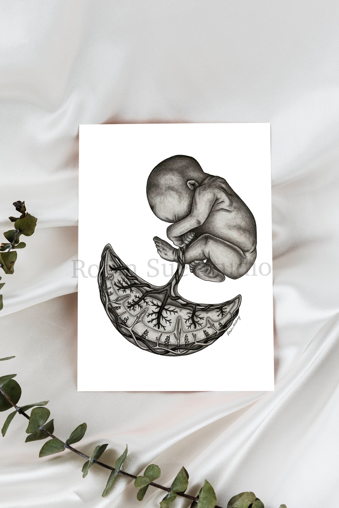 Placenta Art for OBGYN Gift for Midwife Gift for Doula Gift for Labor ...