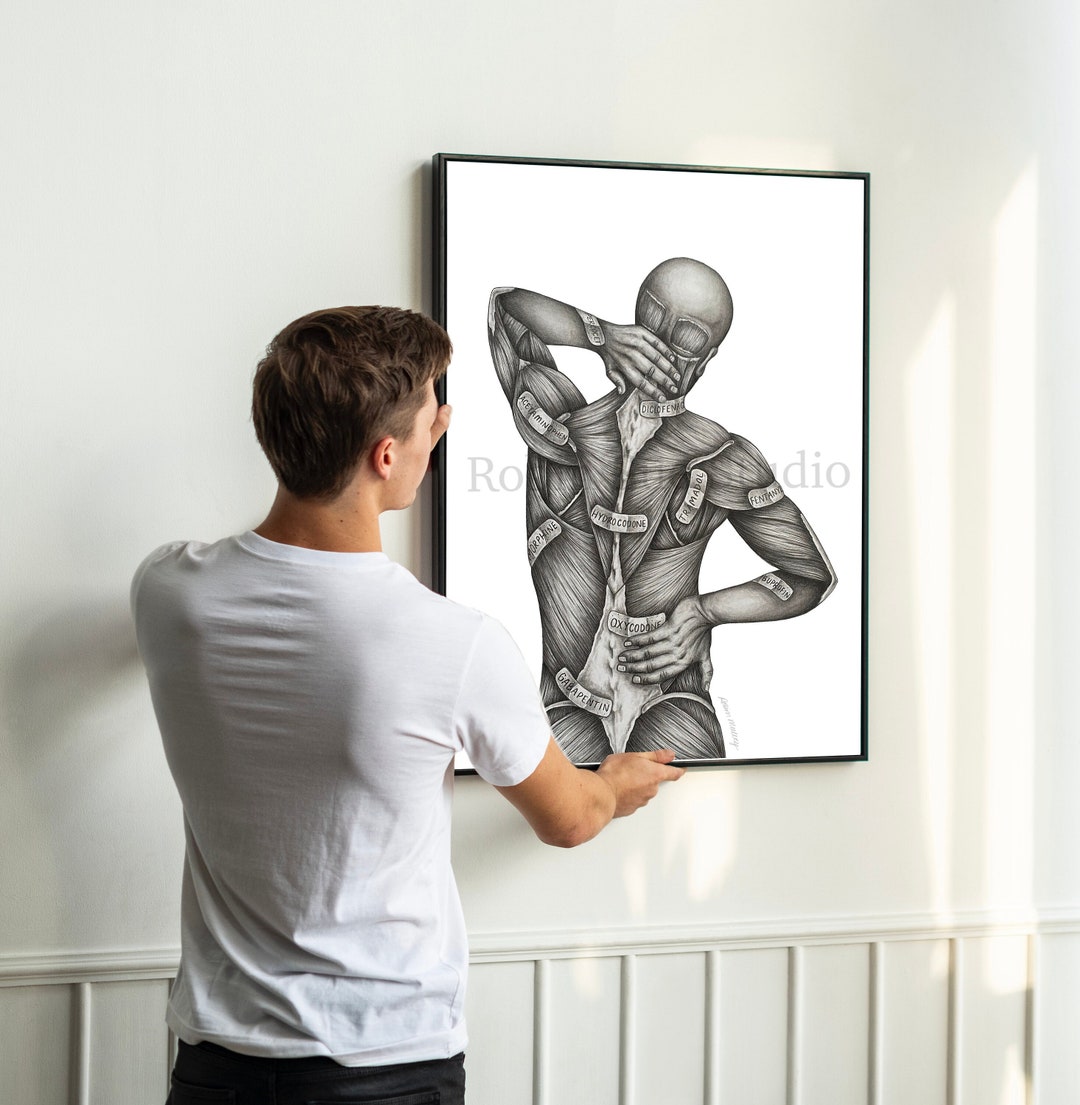 Anatomy Poster for Pain Clinic Wall Art for Chiropractor Office Wall ...