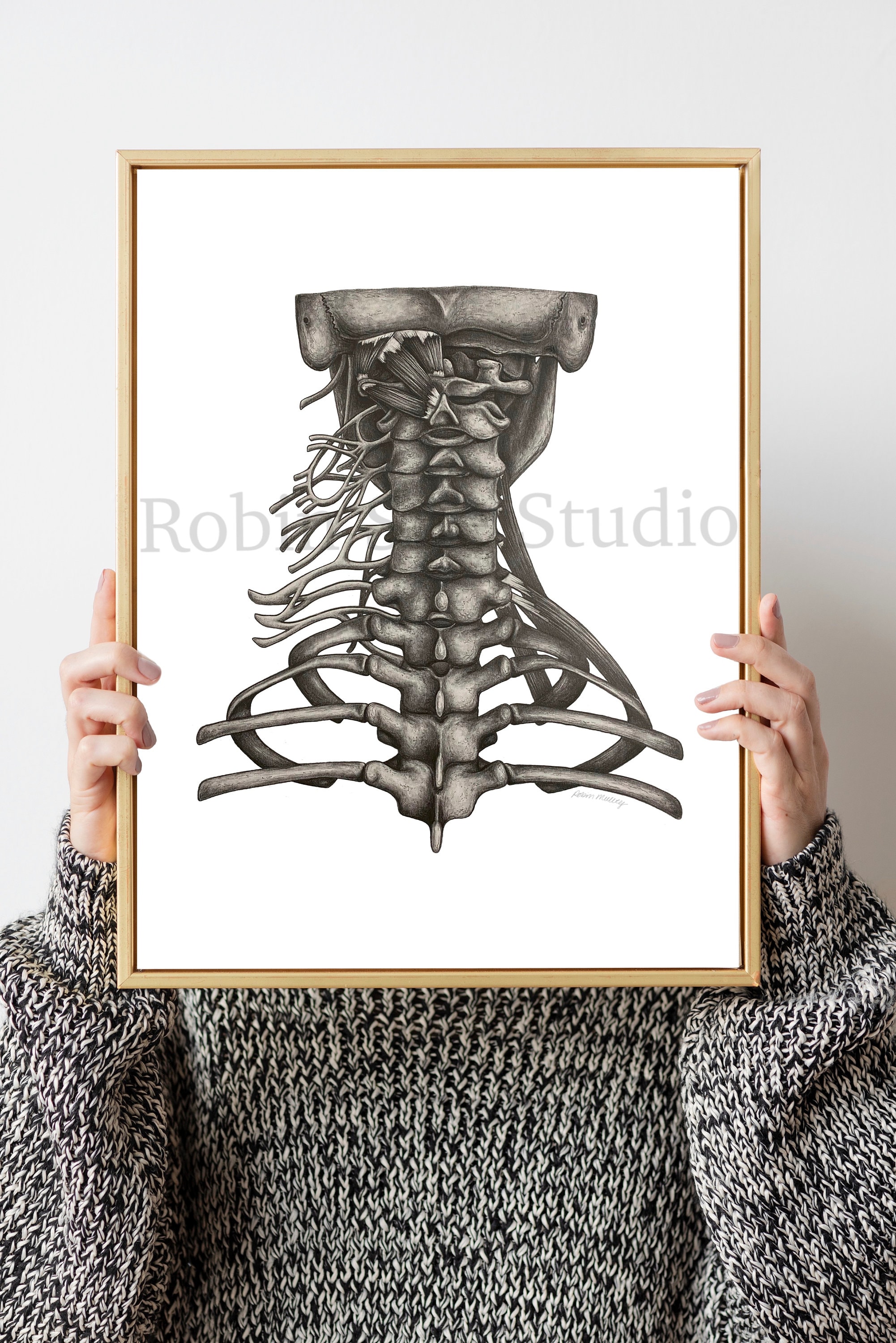 Spine Anatomy Poster Spine Medical Poster for Doctor Office Wall Art ...