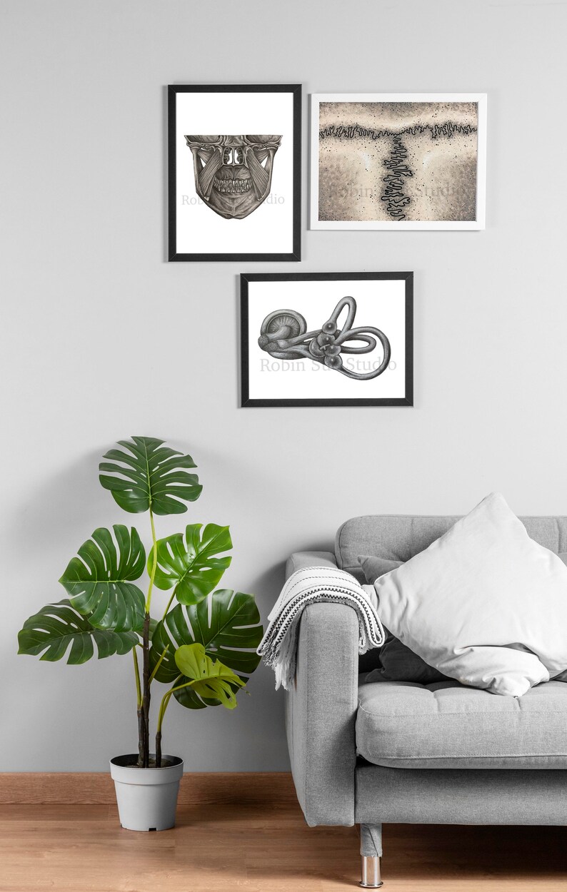 Vestibular Anatomy Poster Vestibular Art for ENT Office Wall Art ...
