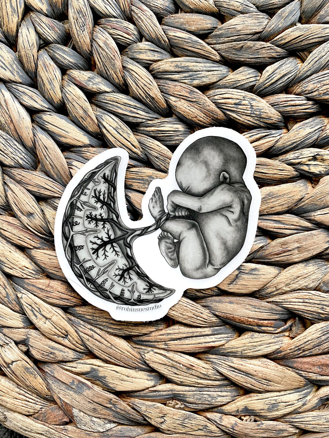 Midwife Gift Newborn Art Placenta Anatomy Sticker for OBGYN Sticker ...