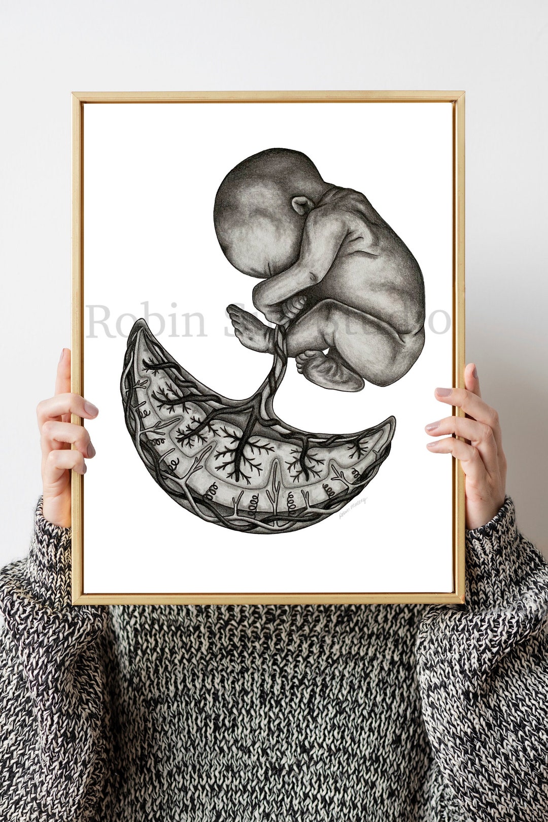 Placenta Anatomy Poster for Birth Center Decor for OBGYN Clinic Wall ...