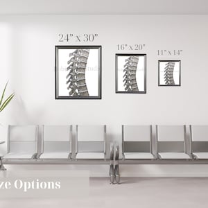Spine Anatomy Poster Medical Decor for Doctor Office Decor for Waiting ...
