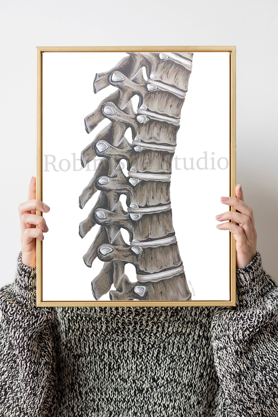 Spine Anatomy Poster Medical Decor for Doctor Office Decor for Waiting ...