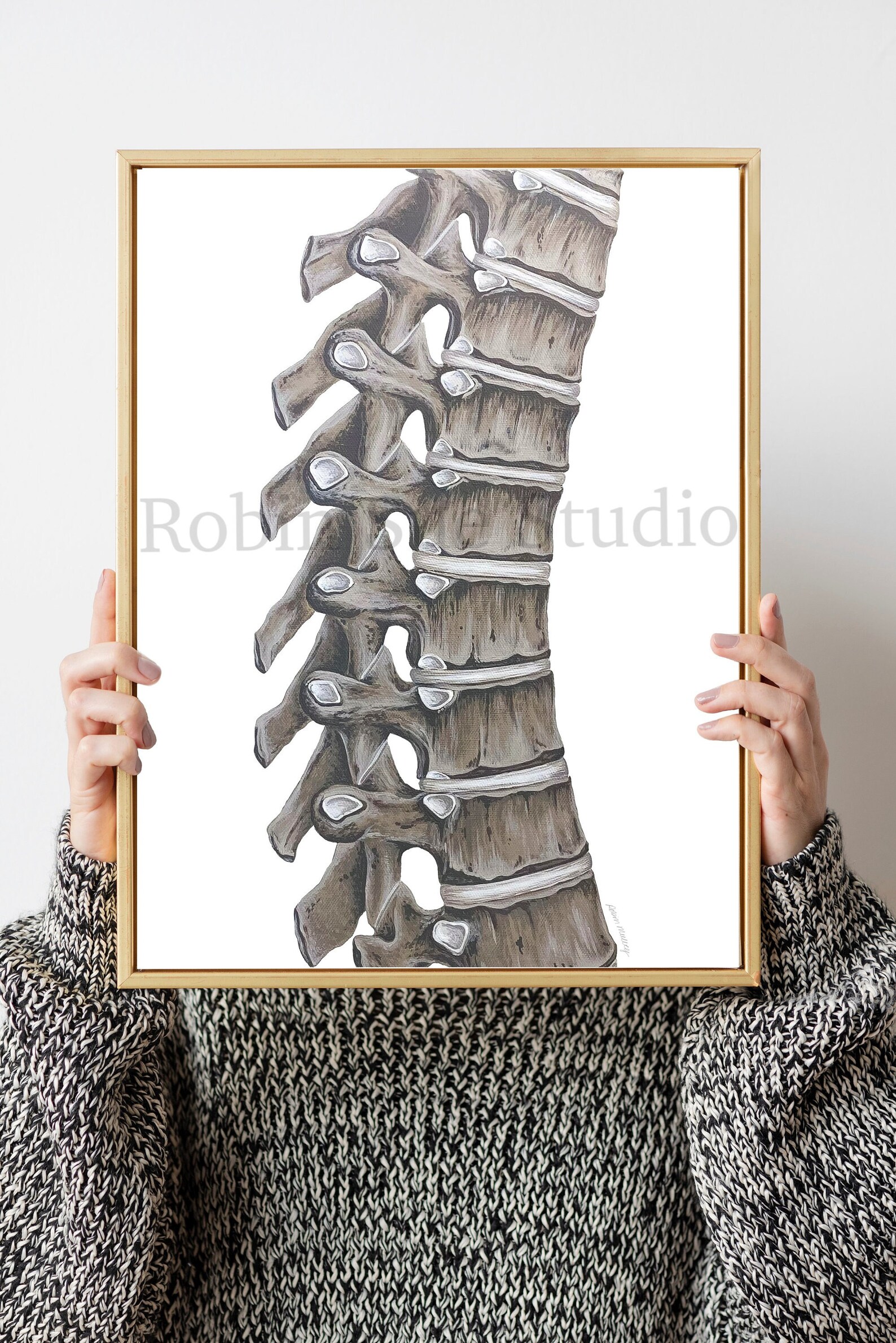 Spine Anatomy Poster Medical Decor for Doctor Office Decor for Waiting ...