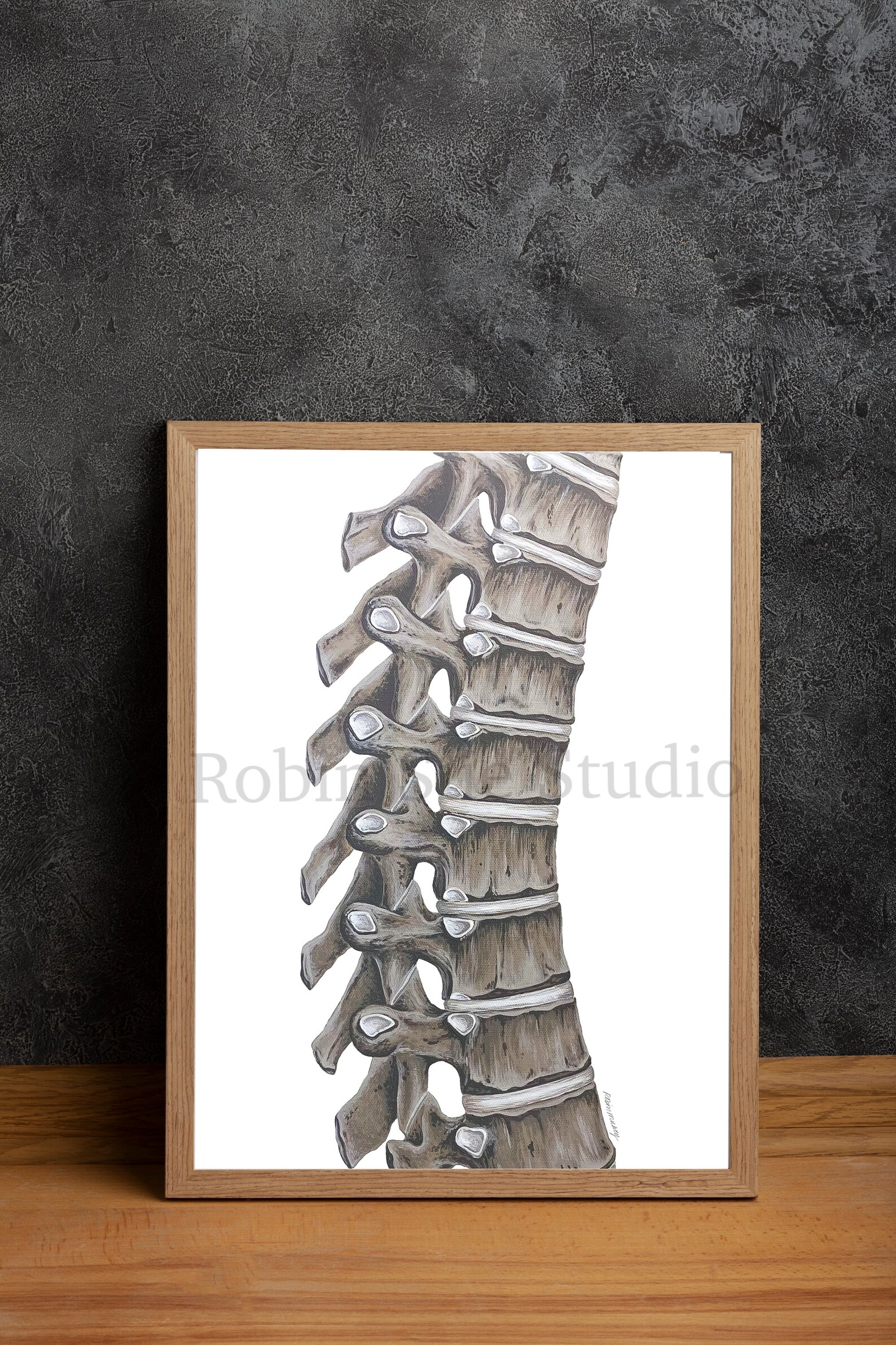 Spine Anatomy Poster Medical Decor for Doctor Office Decor for Waiting ...