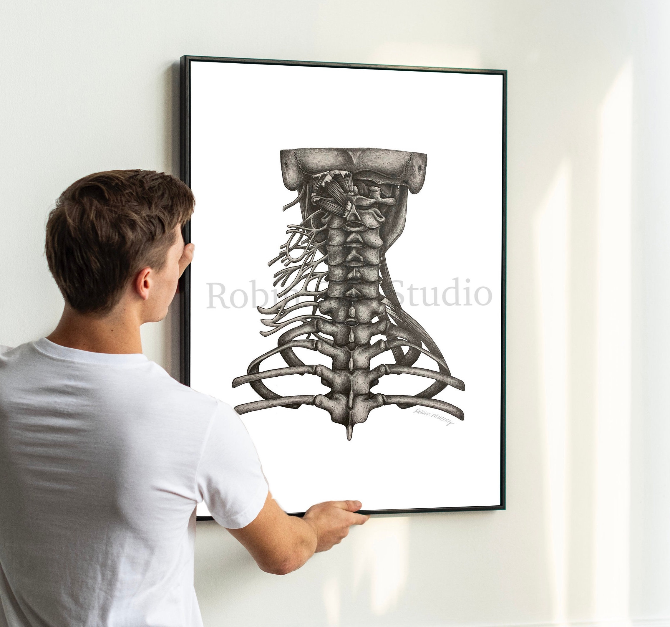 Spine Anatomy Poster Spine Medical Poster for Doctor Office Wall Art ...