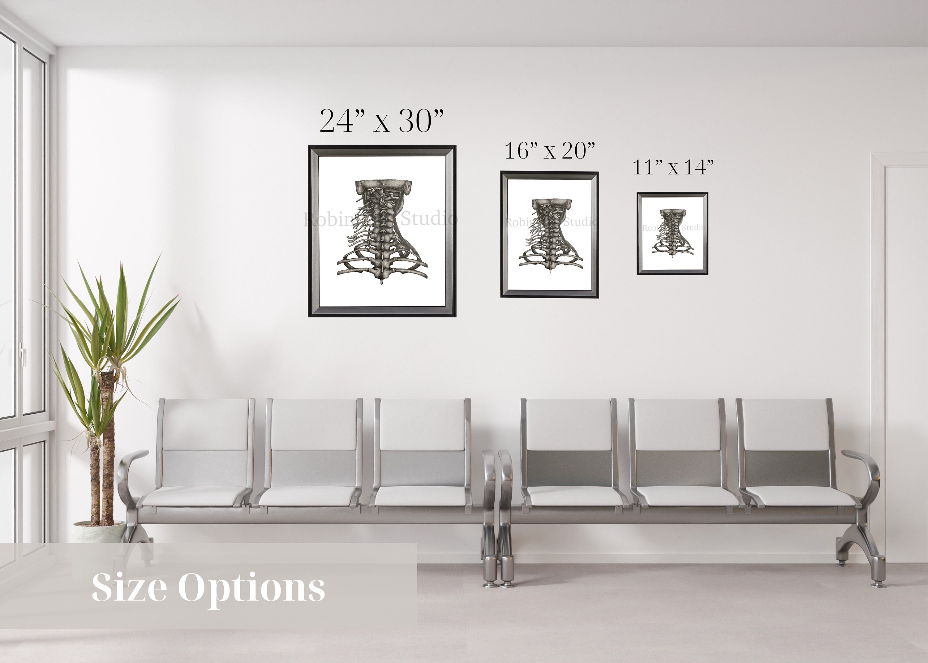 Spine Anatomy Poster Spine Medical Poster for Doctor Office Wall Art ...