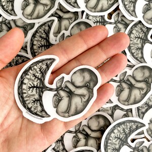 Midwife Gift Newborn Art Placenta Anatomy Sticker for OBGYN Sticker ...