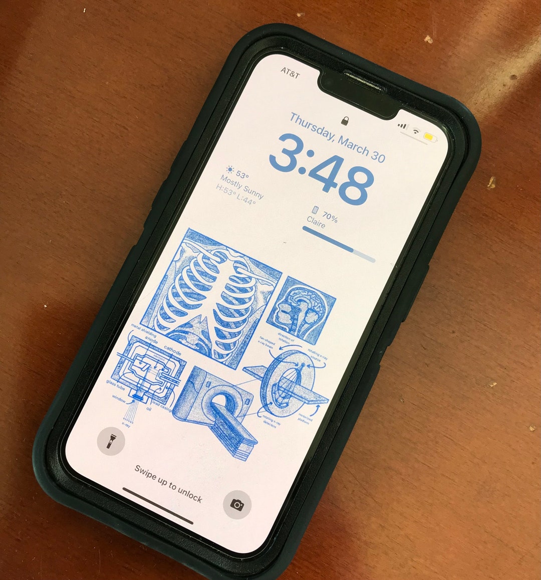 Radiology/xray/ct Scan/cat Scan iPhone Wallpaper (blue With Light Tan ...