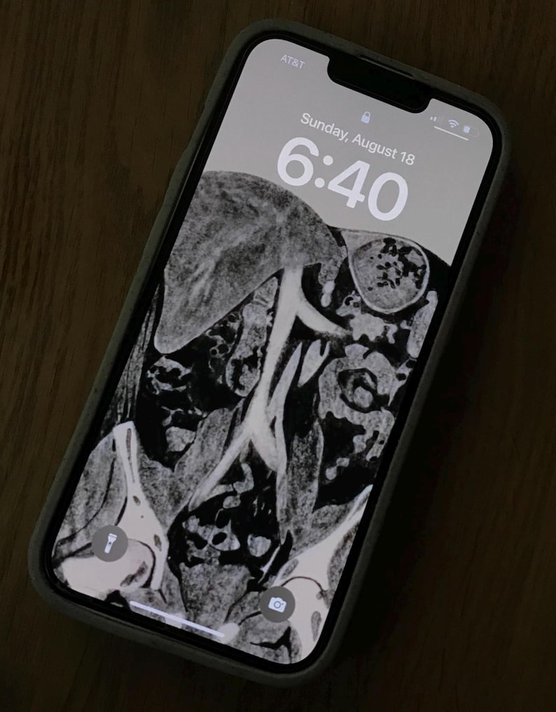 Regular iPhone Wallpaper of CT Scan of Abdomen - Medical Art iPhone ...