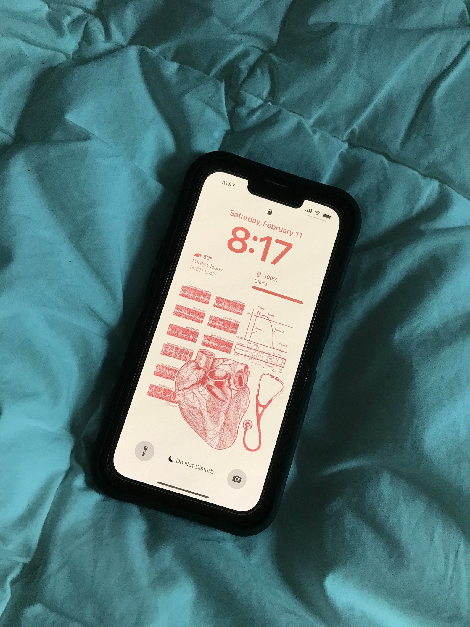 Cardiology/heart Anatomy iPhone Wallpaper & Background (ORANGE/BEIGE ...
